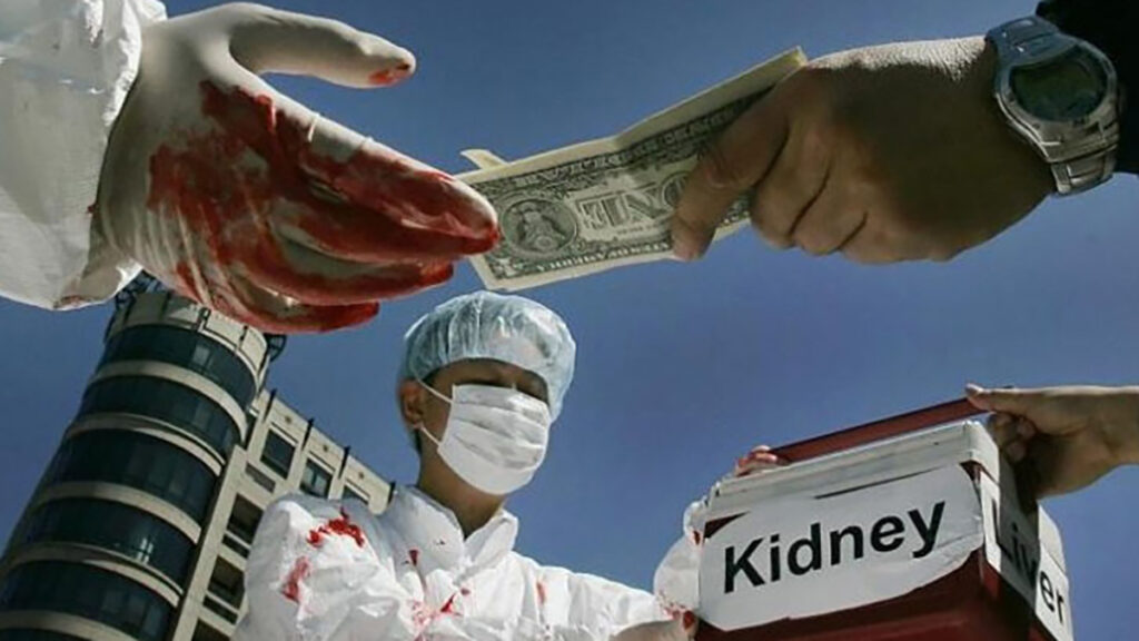 Smugglers sell kidneys to foreigners! – Sri Lanka Mirror – Right to ...