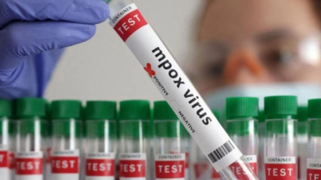 India’s first suspected Mpox case reported – Sri Lanka Mirror – Right ...